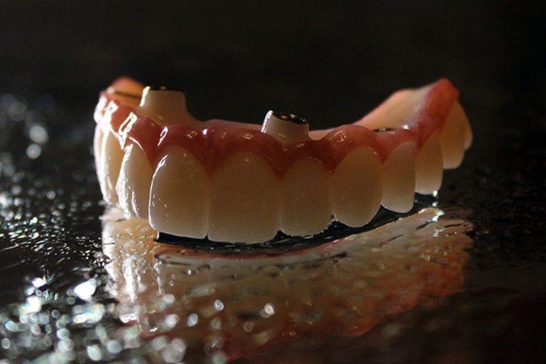 Advanced Zirconia Fixed Bridges | Crestline Dental Implant Center